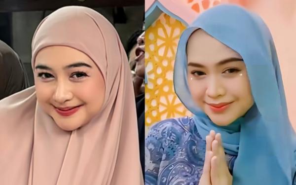 Ria Ricis Akui Operasi Hidung, Alasannya Idap Gangguan Pernapasan 5 Tahun